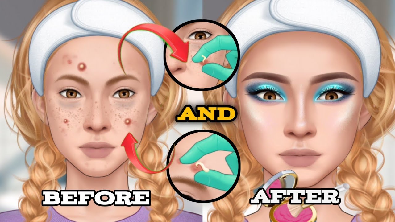 ASMR the best treatment for skin || Asmr animation #asmrvideo - YouTube