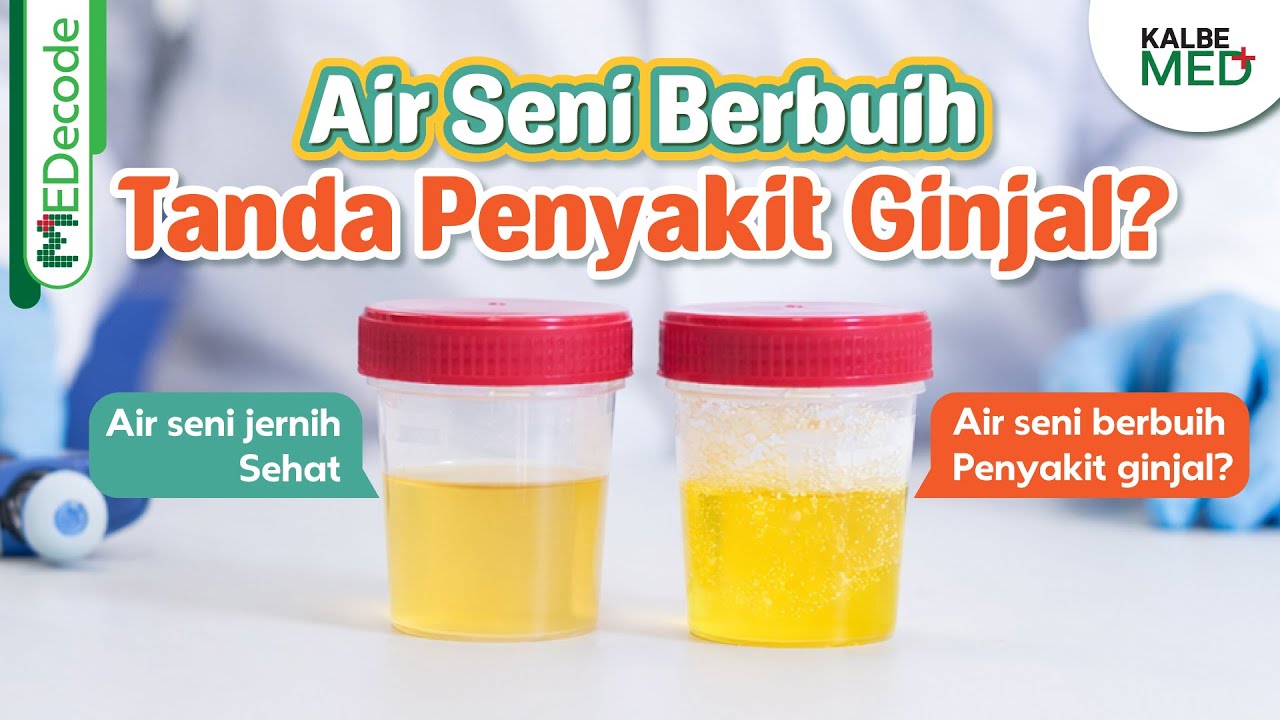 Air Seni Berbuih Tanda Penyakit Ginjal? #MEDecode - YouTube