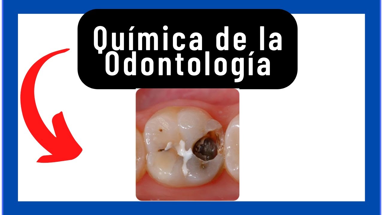 Quimica de odontología - YouTube