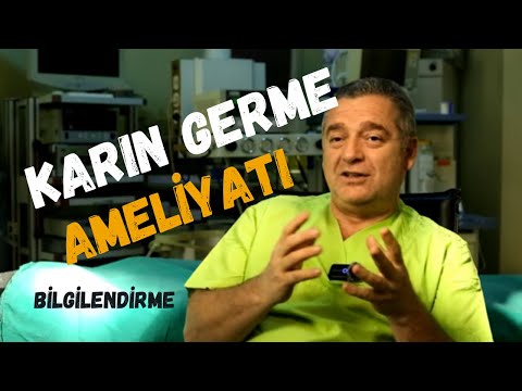 Karın Germe Ameliyatı:  Sıkça Sorulan Sorular BİLGİLENDİRME !