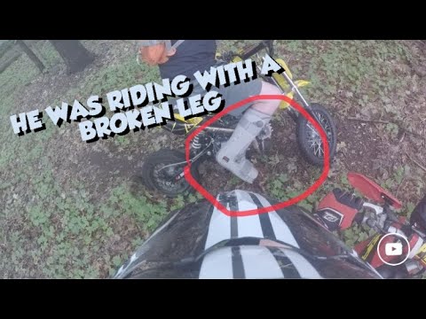 Riding his dirtbike with a broken leg!!??? - YouTube