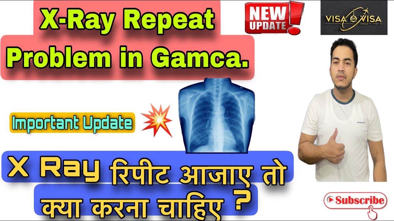 Gamca X- Ray Repeat क्यों होता है ? क्या करने से फिट होगा ? पूरी ...