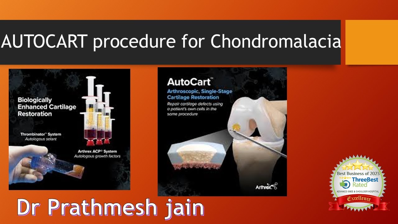 Autocart Procedure for cartilage defects . Dr Prathmesh Jain. Advance ...