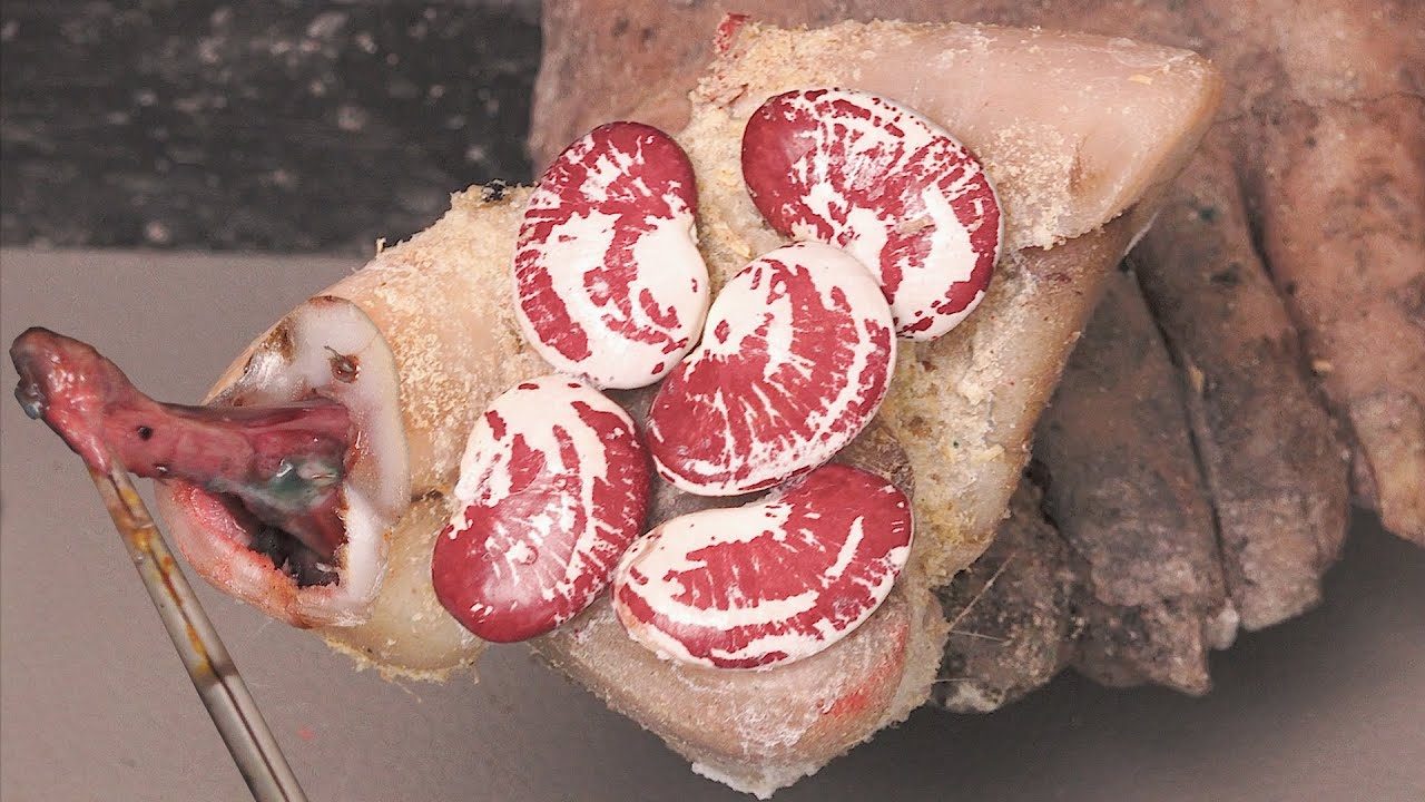 Amazing Toenails, Too Thick, Trim Them Slowly 👣 Professional pedicure ...