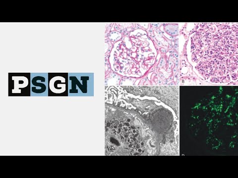 PSGN - Nephritic syndrome - YouTube