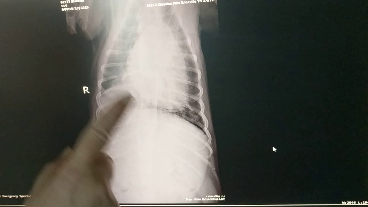 Labrador Retreiver with Primary Lung Cancer Xray and Side effects - YouTube