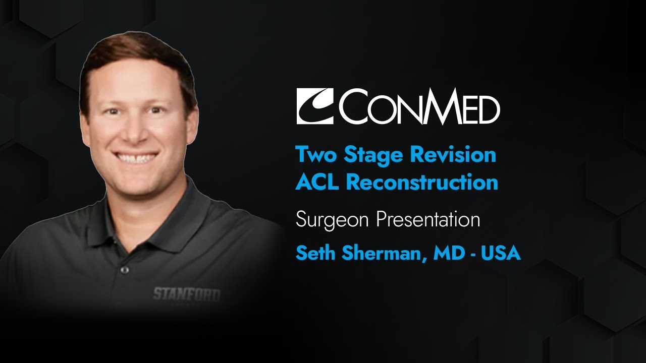 Two Stage Revision ACL Reconstruction - Seth Sherman, MD - Presentation ...