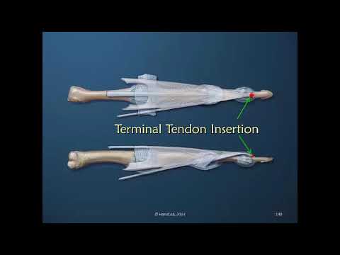 Understanding the Dorsal Apparatus of the Finger; Part 9 of 11 ...