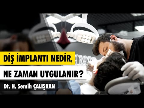 Diş İmplantı Nedir? Hangi Şartlarda Uygulanır? Dental İmplant - Dt. H. Semih Çalışkan (Osmaniye)