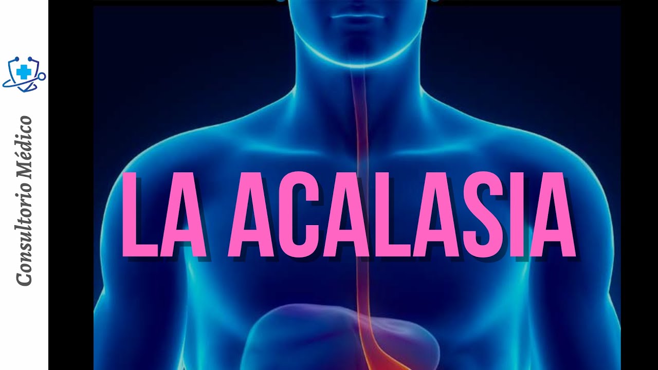 La Acalasia | Definición, Síntomas, Causas, Diagnóstico y Tratamiento 👨 ...
