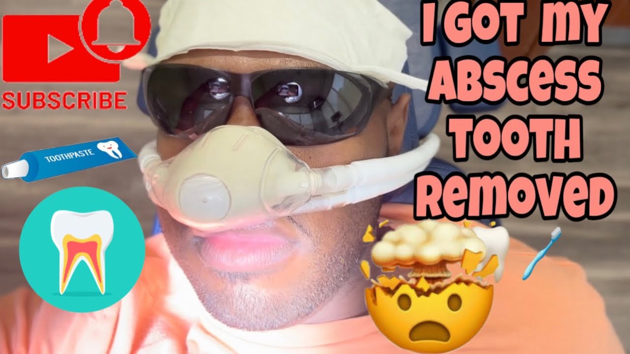 GRWM TO REMOVE MY ABSCESS TOOTH 🦷 - YouTube
