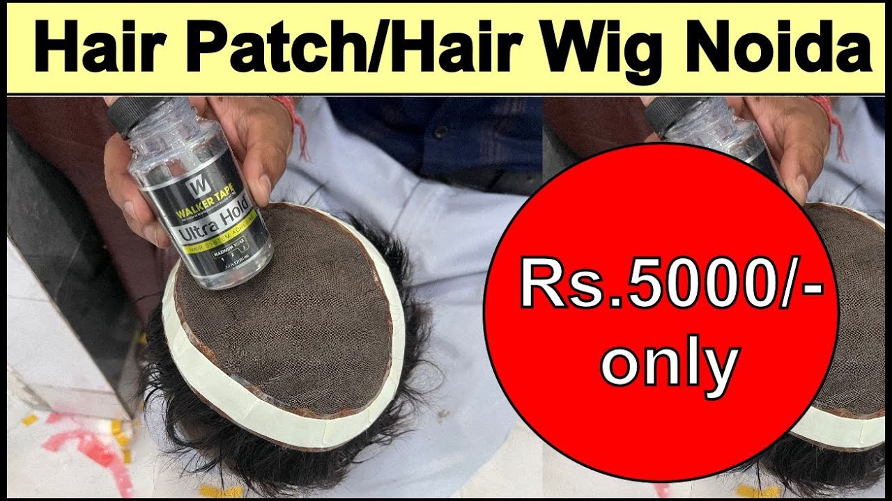Hair Wig/ Hair Patch in Noida, Up | Hair loss treatment | Wigs for men ...