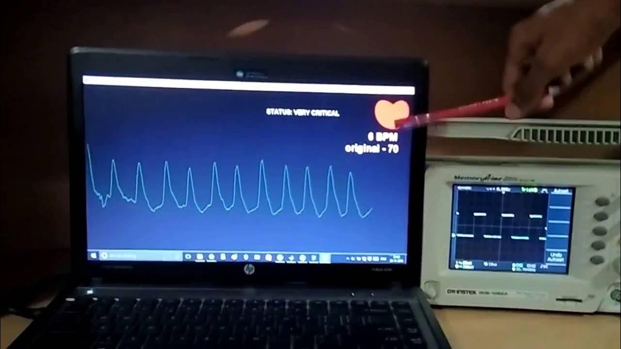 External Pacemaker using Arduino - YouTube