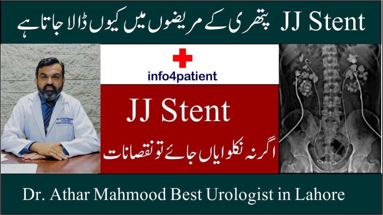 JJ Stent (DJ Stent removal of kidney stones) Dr. Athar Mahmood - YouTube