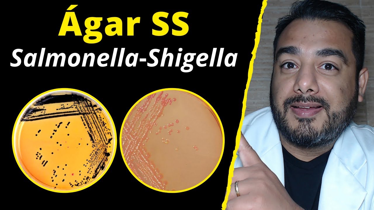 7) Ágar Salmonella Shigella (SS) | Meio de Cultura Seletivo | Concurso ...