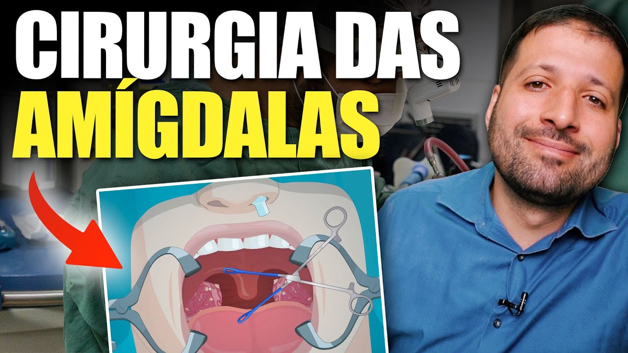 CIRURGIA DAS AMÍGDALAS, COMO É O PÓS OPERATÓRIO? - YouTube