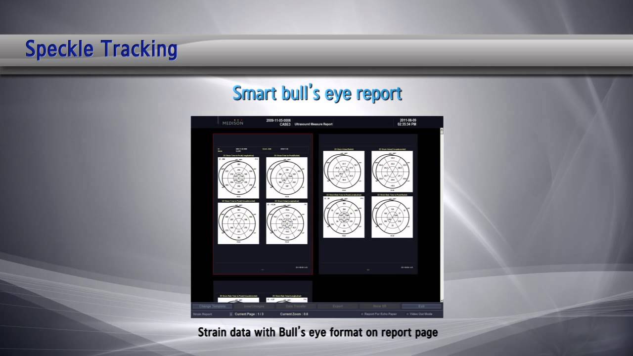 Ultrasound EKO7 Digital PT v1.0 - YouTube