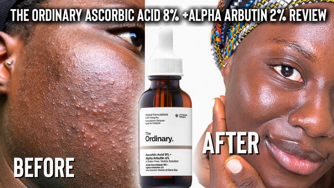 The Ordinary Ascorbic Acid 8 Alpha Arbutin 2 Vitamin C Serum