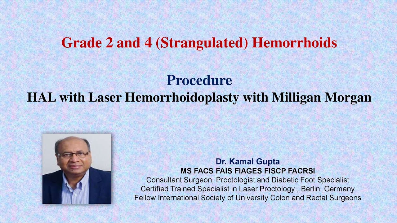 Grade 2 and 4 Strangulated Hemorrhoids - YouTube