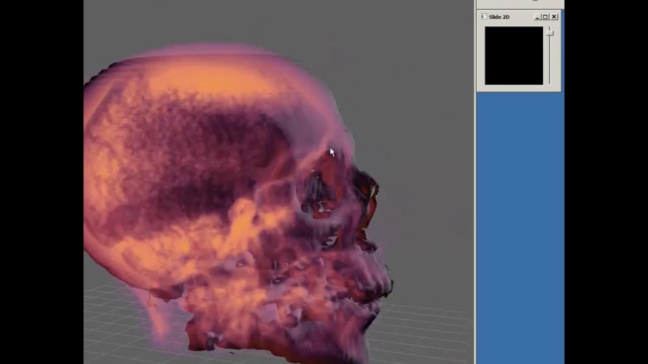 Realtime 3D Visualization of an MRI data set using HARFANG® Python ...