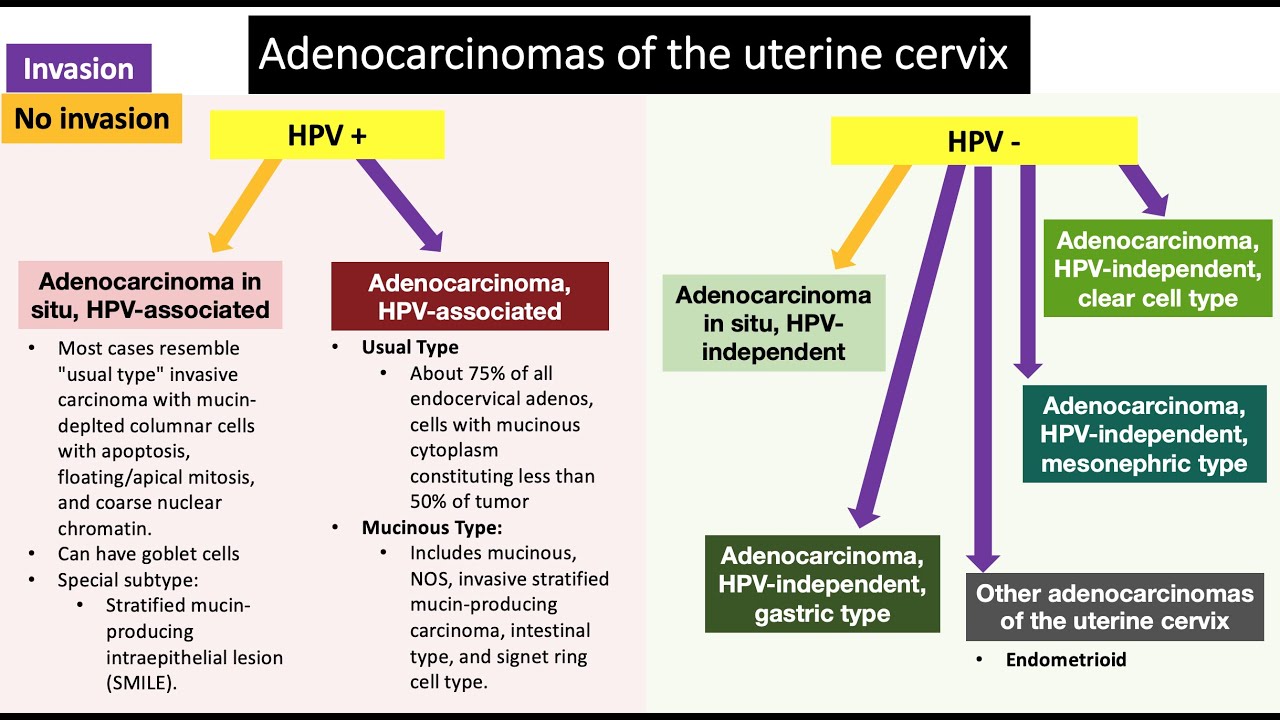 Endocervical Lesions - YouTube