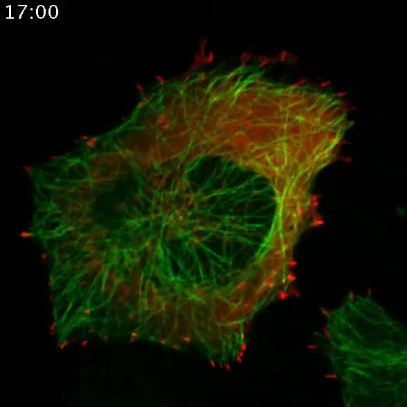 KANK proteins control adhesions by linking to microtubules - YouTube