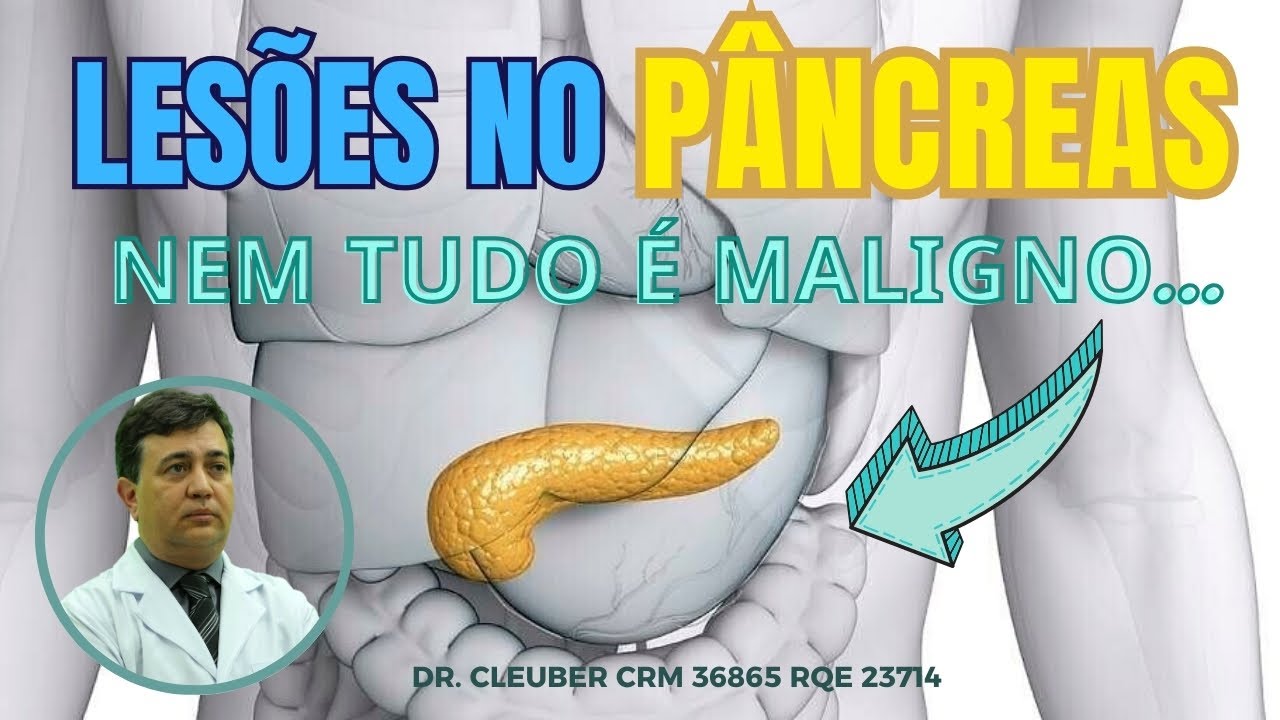 Lesão no Pâncreas: Doenças que podem Confundir o Diagnóstico. - YouTube