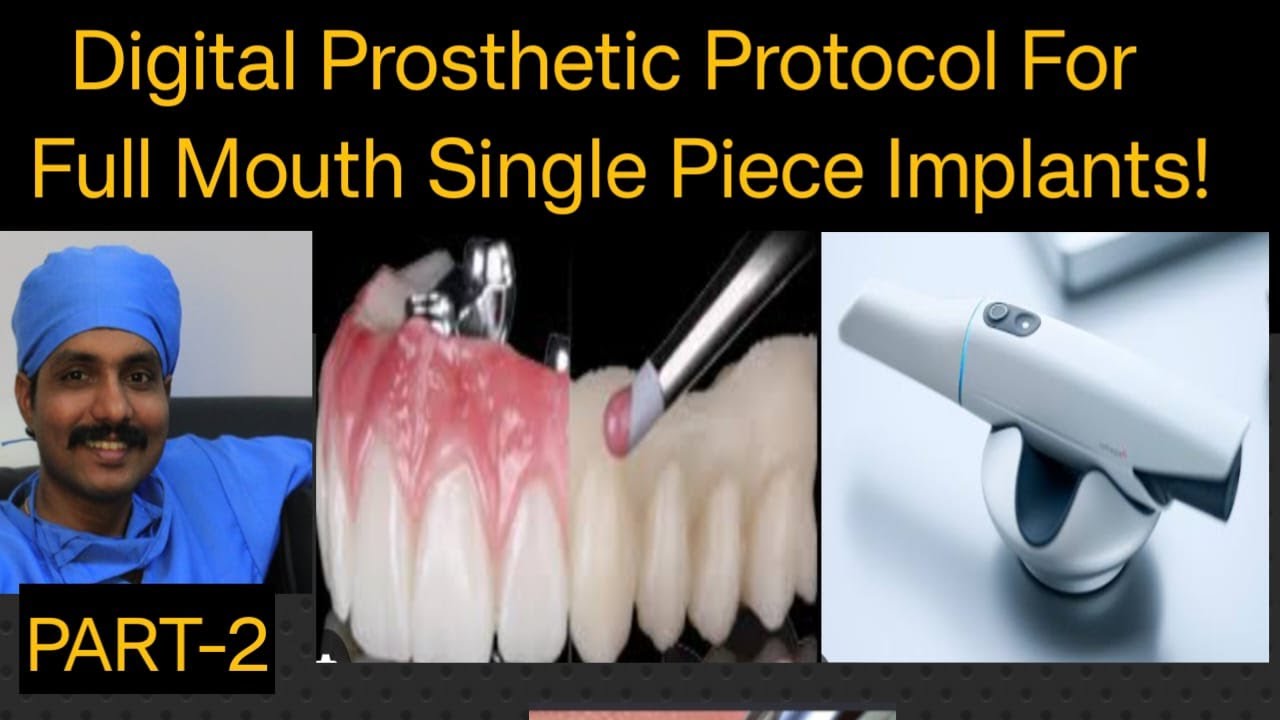 Part 2-Digital workflow for full mouth prosthesis with single piece dental implants by Dr ...
