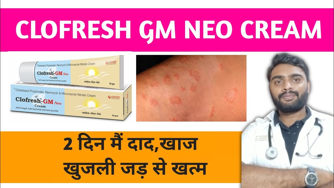 2 दिन मैं दाद,खाज खुजली जड़ से खत्म - Clofresh gm neo cream | Clofresh ...