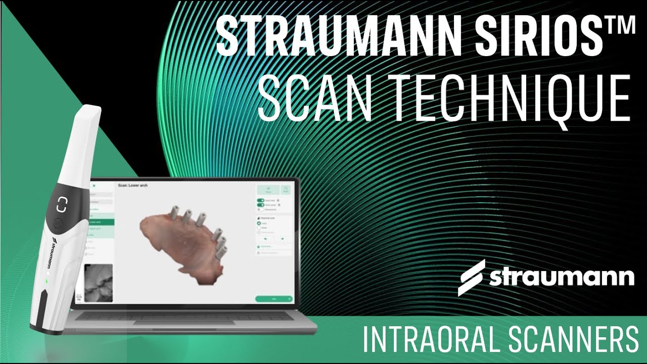SIRIOS Scan Technique - YouTube