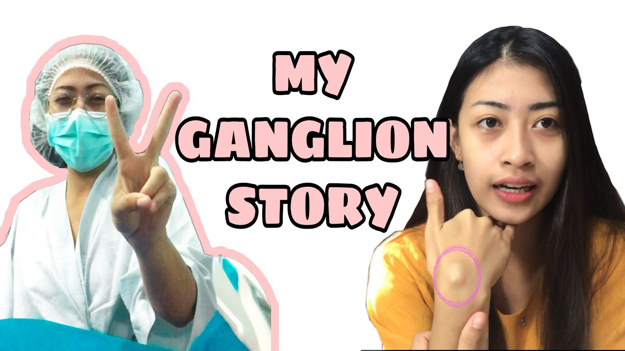 OPERASI GANGLION DI TANGAN DENGAN ANESTESI UMUM | TRI UTARINI - YouTube