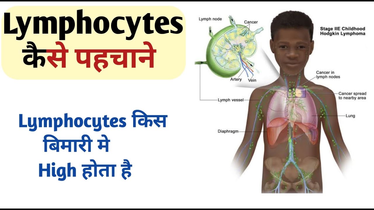 causes of high lymphocytes I causes of low lymphocytes - YouTube
