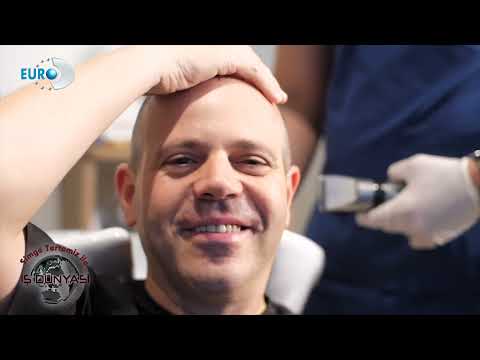 Berkay Tulpar ile Saç Ekimi Hakkında Sohbet - İş Dünyası Euro D