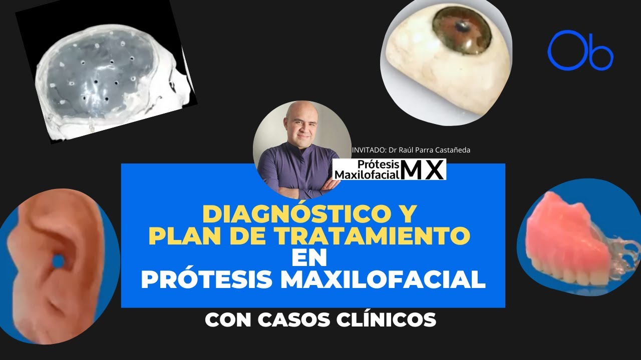 Diagnóstico y Plan de tratamiento en Prótesis Maxilofacial + Casos ...