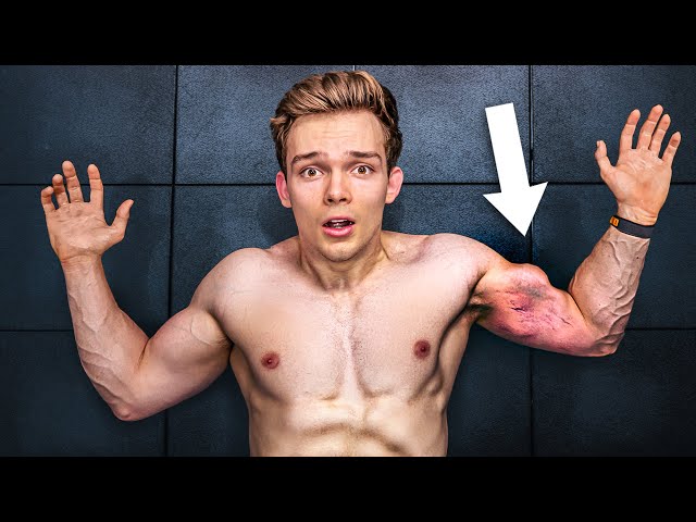 Worst Injury Ever Survived