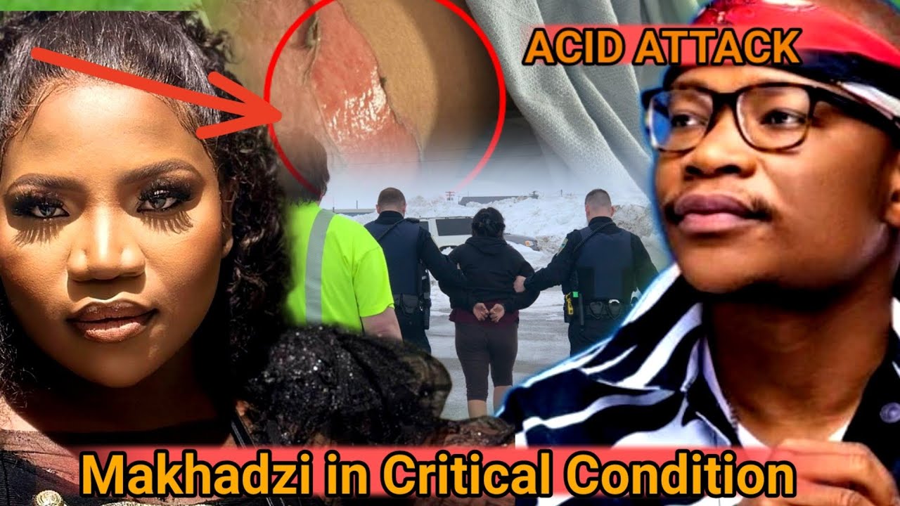Makhadzi Rushed to Hospital After Master KG’s New Girlfriend Pours Acid ...