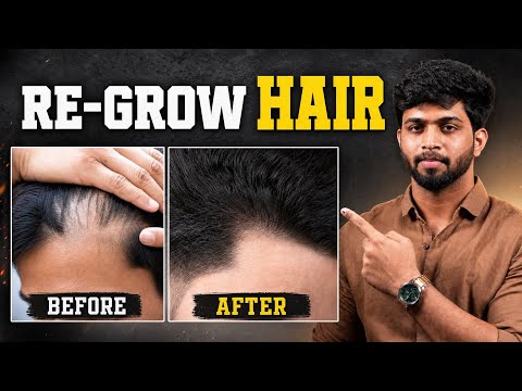  The Hair Regrowth Guide Every Man Needs | 2026