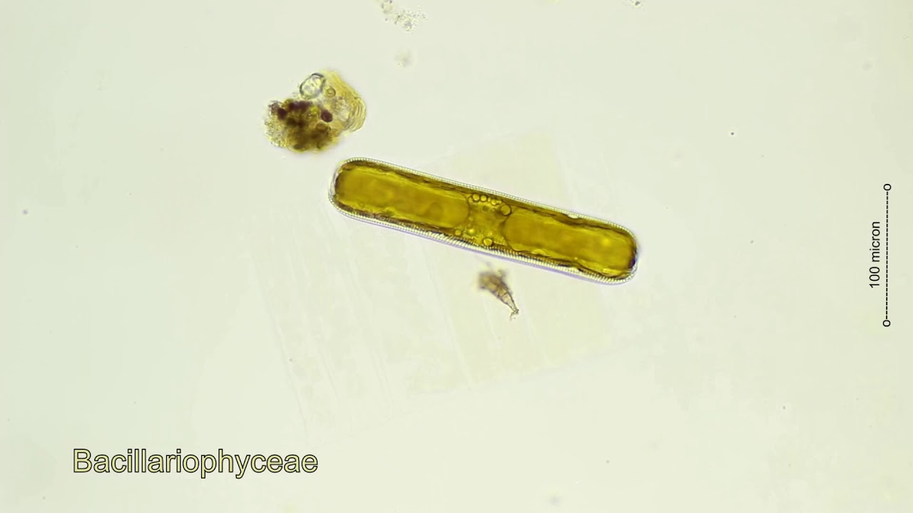 Bacillariophyta - YouTube