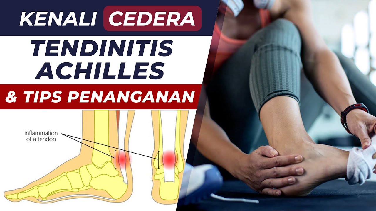 CEDERA ACHILLES - Kenali Tendinitis Achilles & Tips Penanganannya ...