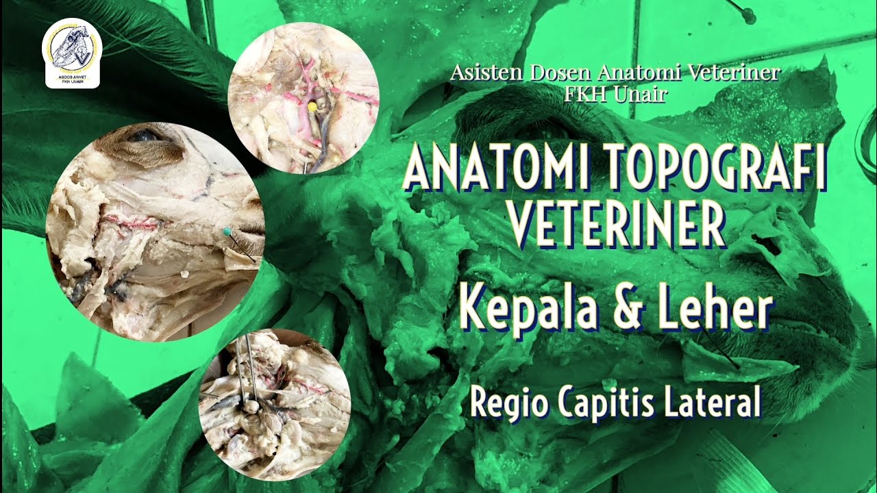 Anatomi Topografi : Regio Capitis Lateral - YouTube