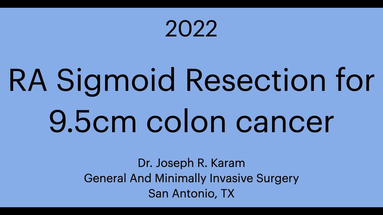 RA Sigmoid resection for Colon Cancer - High Ligation - YouTube