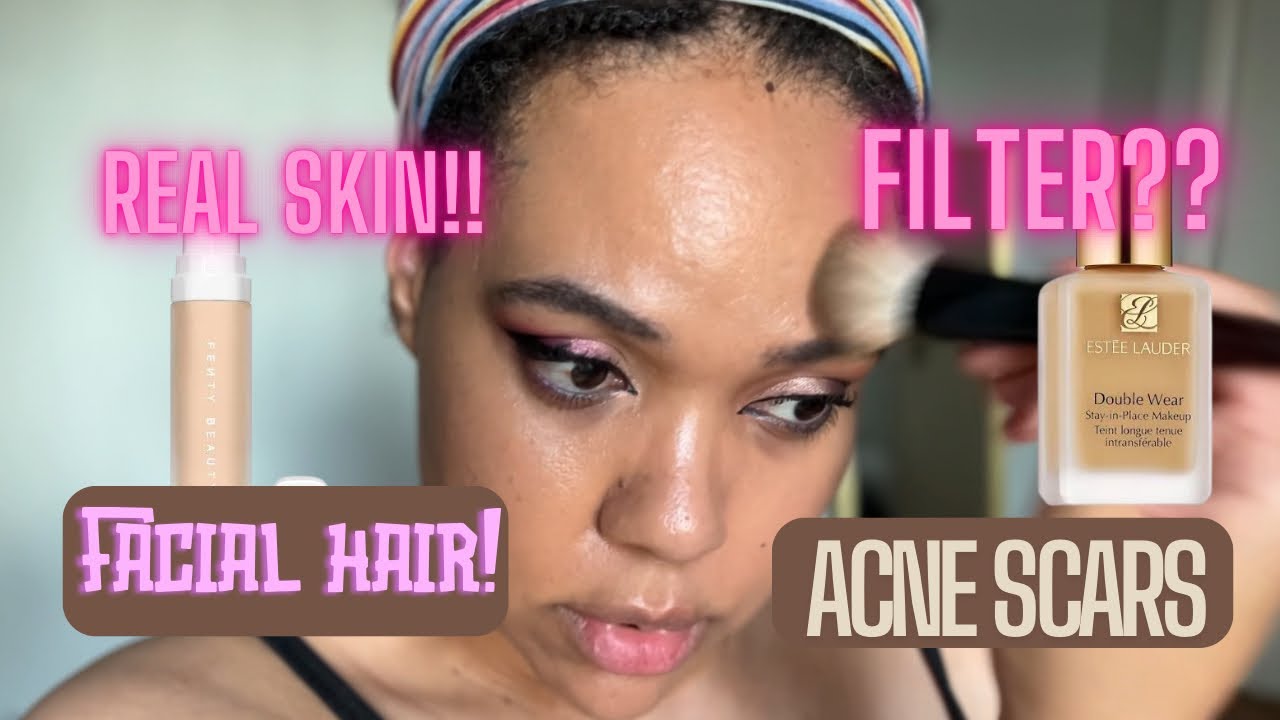 REAL SKIN NO FILTER // ACNE SCARS, HAIR, DARK SPOTS // WHAT FOUNDATION ...