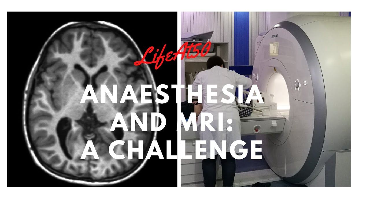 Anaesthesia and MRI: A Real Challenge - YouTube