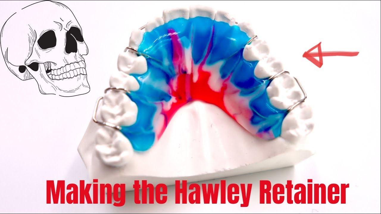 Making a Hawley Retainer - YouTube