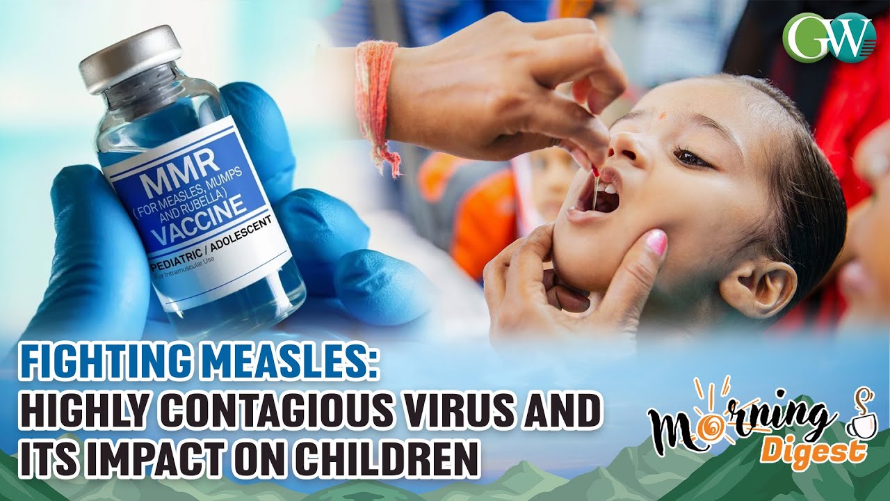 FIGHTING MEASLES :HIGHLY CONTAGIOUS VIRUS AND ITS IMPACT ON CHILDREN ...