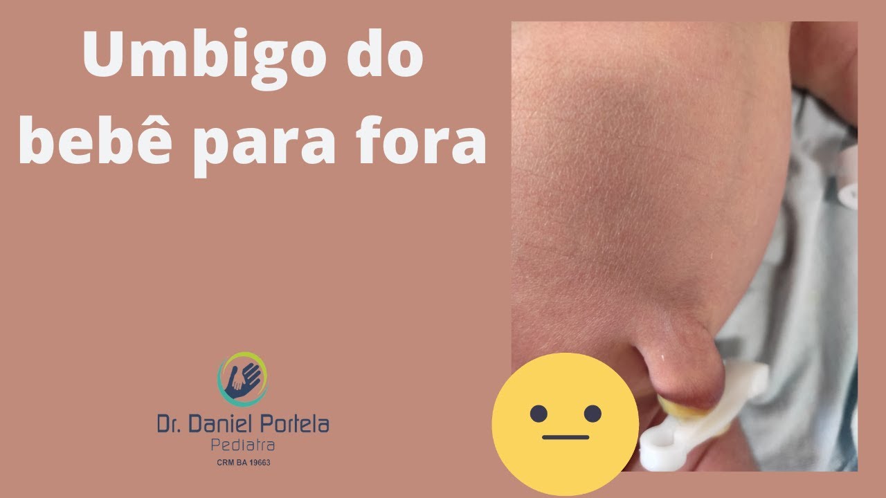 Umbigo Sangrando De Recem Nascido - LIBRAIN