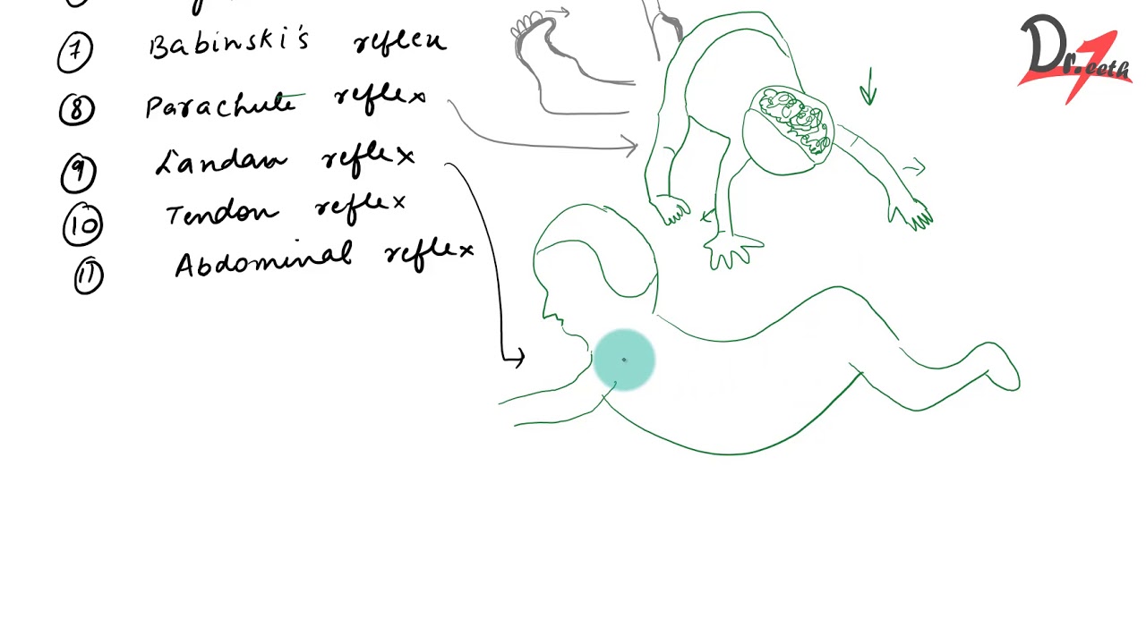 Pedologic anatomy : Reflexes in child - YouTube