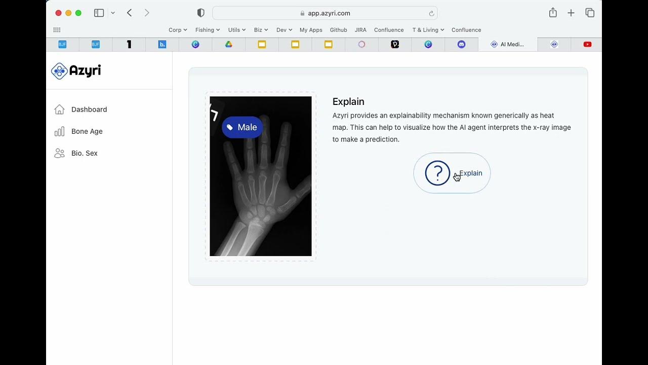 Mary The Artificialintelligence Assistant Guessing Sex From X Ray Image No Human Can Do It