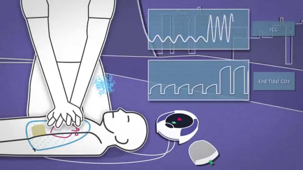 Defibrillatore samaritan PAD 500P, con supporto nella RCP ...