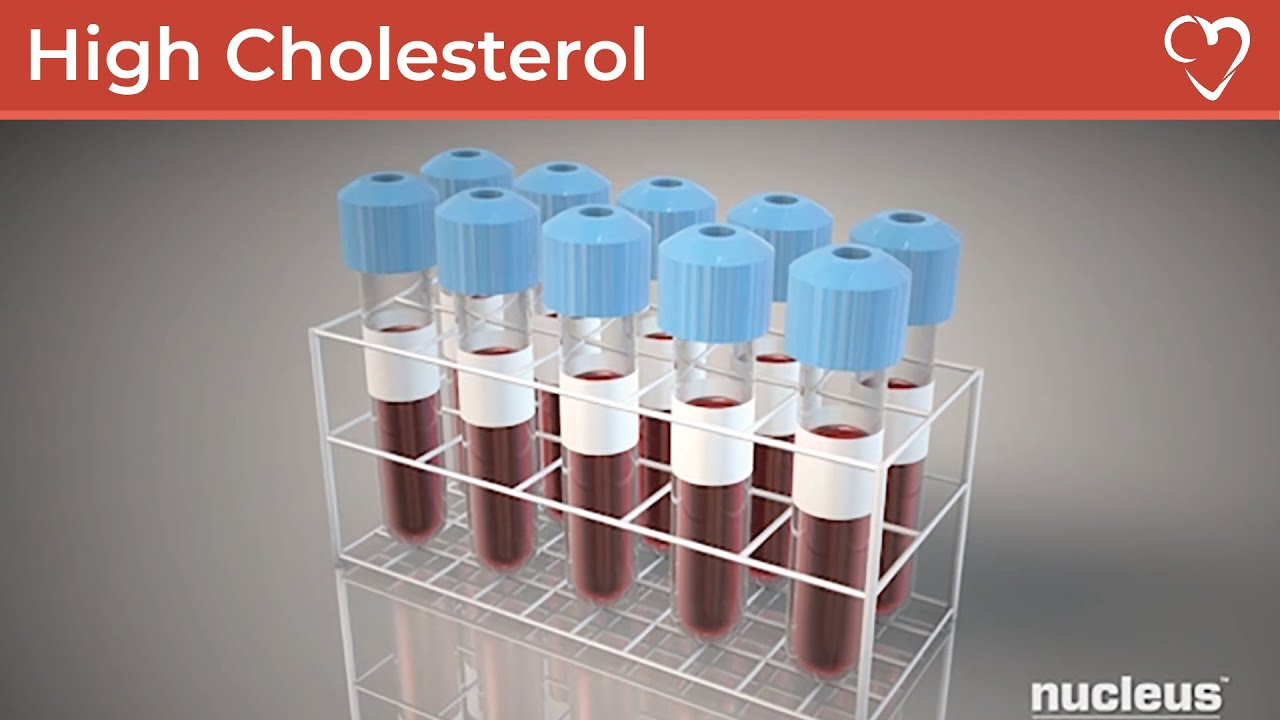 What is High Cholesterol? - YouTube